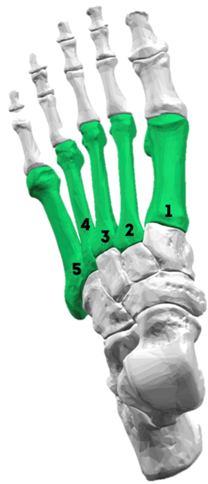 Metatarsal Fracture - Rehab On The Road